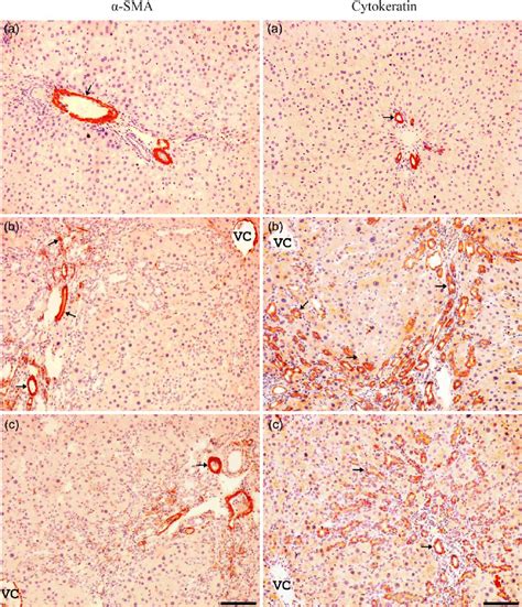 Light Microscopy Of Liver Tissue In Different Groups A Sma A In