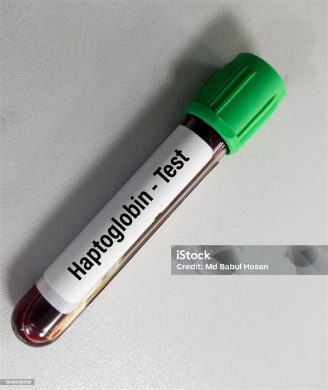 Haptoglobin 검사를위한 샘플이있는 혈액 샘플 튜브 용혈성 빈혈 및 간 질환 진단 헤모글로빈 결합 단백질 Hpt Hp