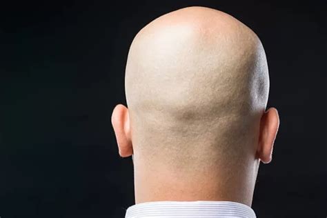 Kenapa Cukur Botak Plontos Lebih Mahal Dari Gaya Rambut Ronaldo Harian Massa Id