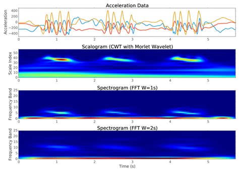 Time Frequency Power Spectrum Of An Acceleration Signal I E Raw Download Scientific Diagram