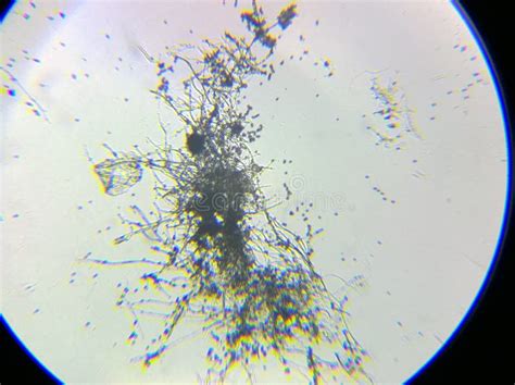 Penicillium Genus Moho Esporas Micelio Bajo Microscopio Imagen De