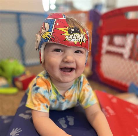 Plagiocephaly Pax Chiropractic