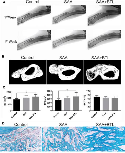 X Ray Micro Ct And Histology Evaluations Of Fractured Radius Calluses