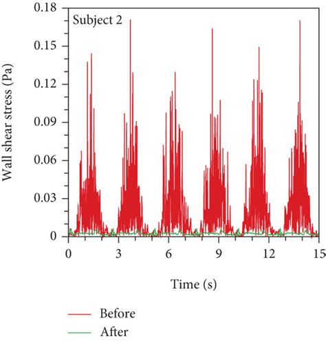 Comparison Of Wall Shear Stress Time Series At The Larynx For Two Osa Download Scientific