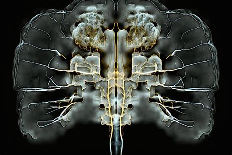 generative ai illustration visualization of computed tomography mri of