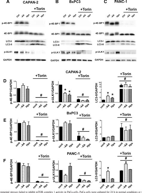 Figure 4 From Roles Of Autophagy And Metabolism In Pancreatic Cancer