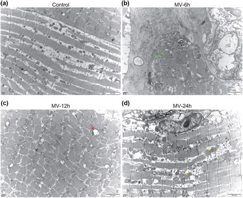 Morphologic Abnormalities Of Mitochondria And Autophagy In The Hot