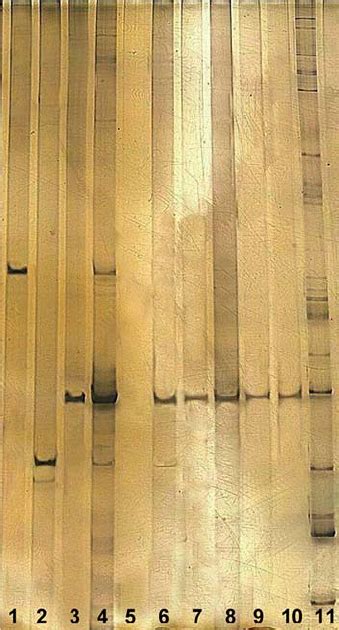 Single Strand Conformation Polymorphism Sscp Of Fungal Dna From