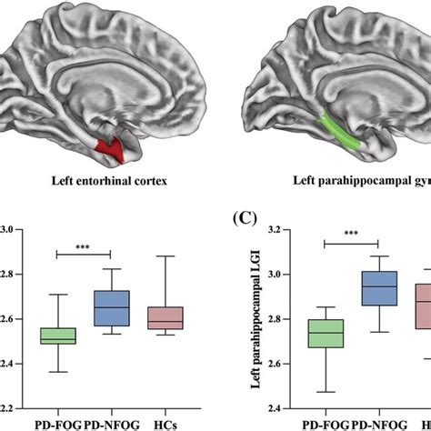 Significant Cholinergic Basal Forebrain Volumetric Differences Among