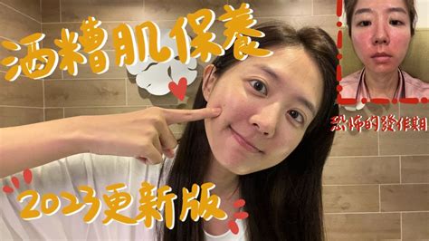 酒糟肌 肌膚終於穩定了 2023年酒糟肌保養品更新啦 一樣有酒糟發作照請小心服用🤣 Youtube