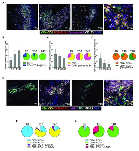 Mihc Analysis Of Skin Infiltrating Ss Cells And Tils A