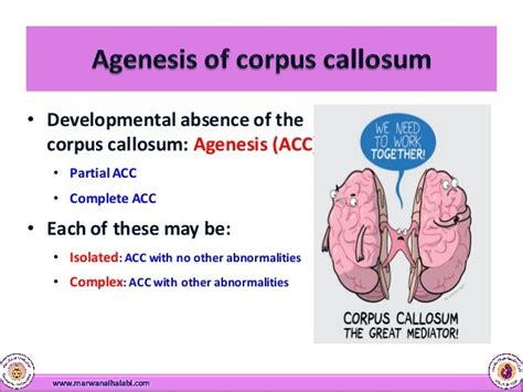 corpus callosum anomalies