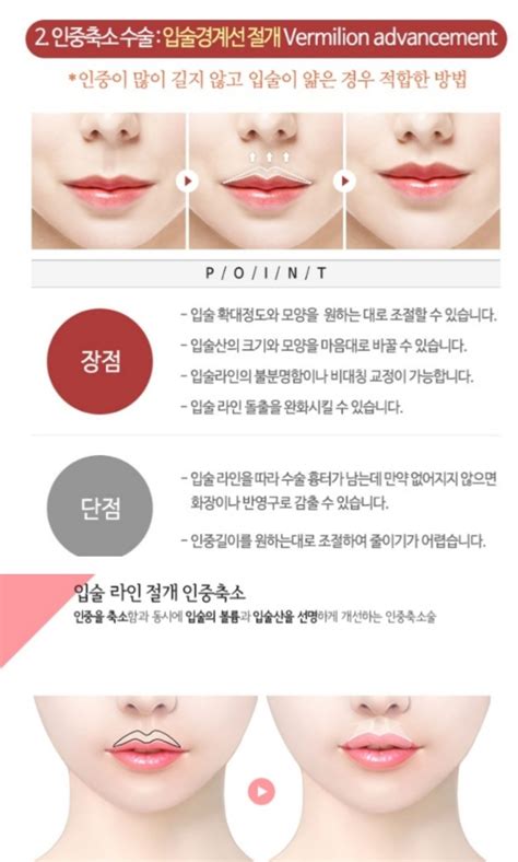 시술수술 질문 입술절개 인중축소 강남언니 1등 성형수술and피부시술 정보앱