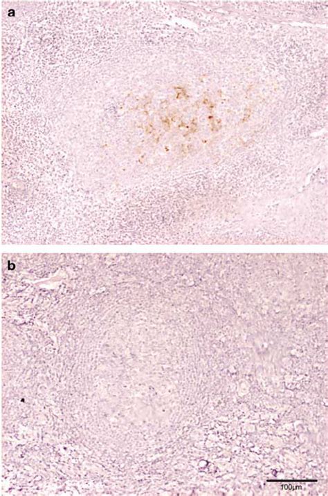 Immunostaining Obtained With 12f10 Automated Procedure In Tonsil Biopsy
