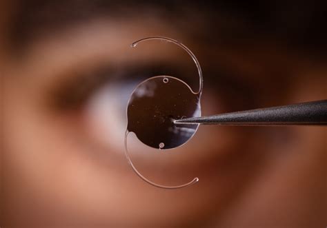 Basics Of Iol What Are Iols Eye Care Professionals
