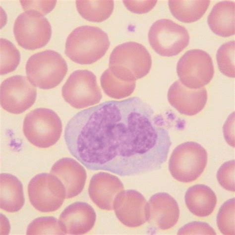 Wright Staining Cellavision