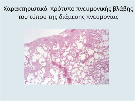Πρότυπα ιστολογικών αλλοιώσεων αναπνευστικού συστήματος Ppt κατέβασμα