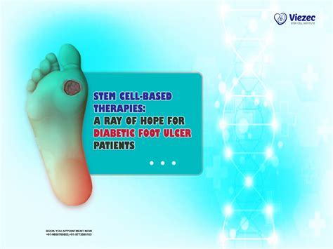 Stem Cell Based Therapies Hope For Diabetic Foot Ulcer Patients