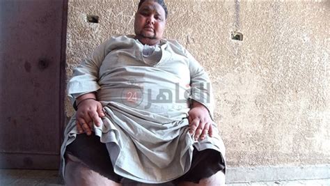 وزنه 300 كيلو شاب من بني سويف مصاب بداء الفيل يستغيث لعلاجه مش بعرف