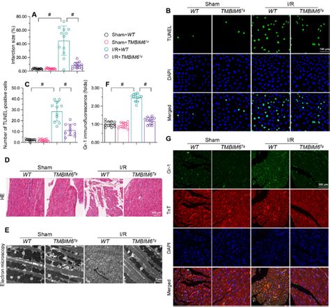 Tmbim6 Overexpression Attenuates Myocardial Ir Injury Tmbim6 Tg Mice