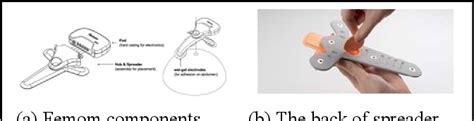 Figure From Evaluation Of The Fetal Heart Rate Monitoring With The Non Invasive