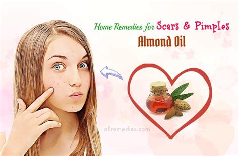 Top 10 Home Remedies For Scars And Pimples On Face Skin Overnight