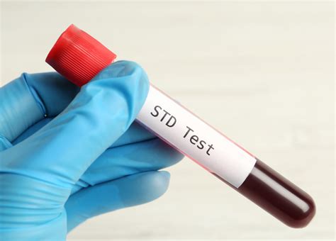 Can You Get STD Testing At Urgent Care Stopwatch Urgent Care