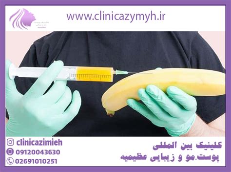 پنو پلاستی چیست؟ کلینیک بین المللی پوست و مو زیبایی عظیمیه