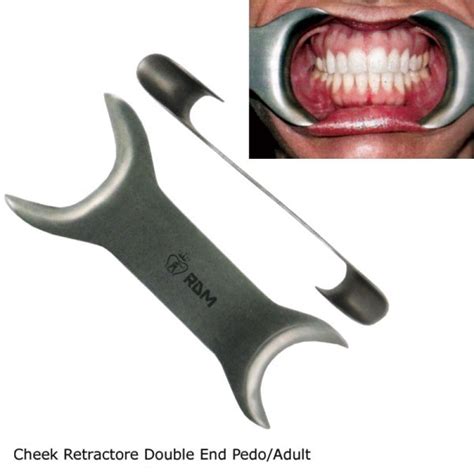 What Is A Cheek Retractor Exploring The Benefits And Uses