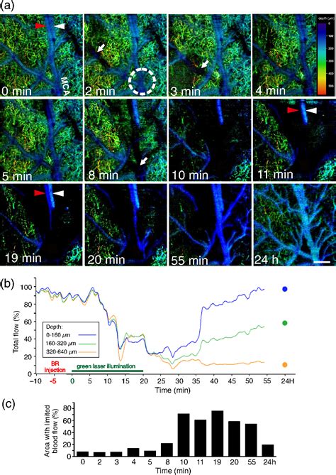In Vivo Brain Imaging With Multimodal Optical Coherence Microscopy In A Mouse Model Of