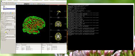 I Got Freesurfer To Run In Wsl Rbashonubuntuonwindows