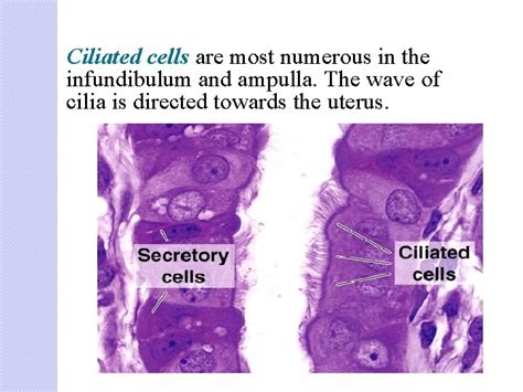 Female Reproductive System Dr Iram Tassaduq Contents Ovaries