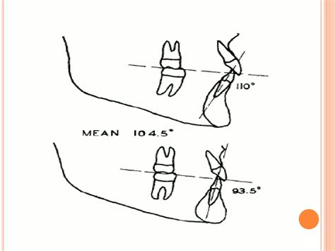 Downs Analysis Original Article Pptx