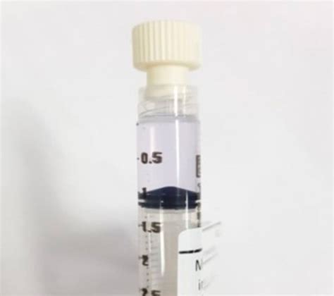 Trabeculectomy With Erroneous Mitomycin C Concentration A Near Miss Eye News