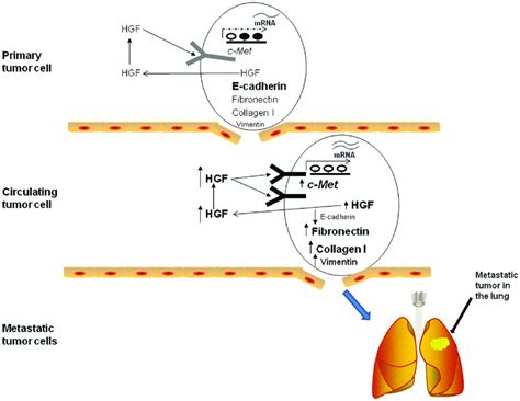 Summary Of Potential Role Of Hgf C Met In Hematogenous Dissemination Of