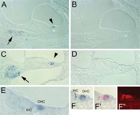 Expression Of Clrn1 In The Mouse Cochlea Detected Using In Situ Download Scientific Diagram