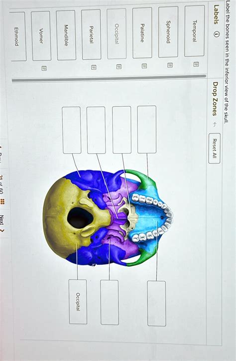 Solved Label The Bones Seen In The Inferior View Of The Skull Labels