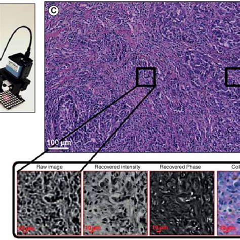 Lensless Microscopy A Cell Phone Based Lens Free Microscope Is Shown