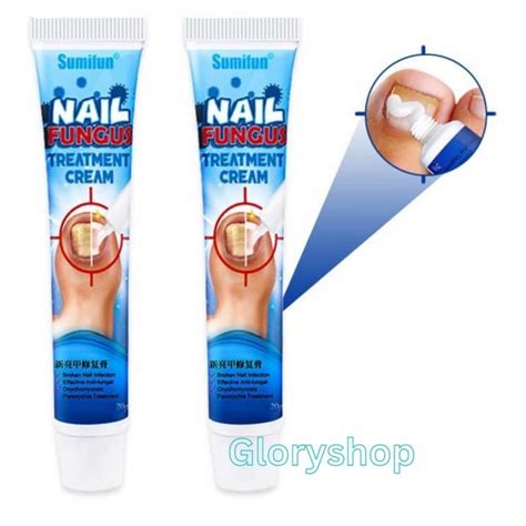 Nail Fungus Removal Cream Ointment Onychomycosis Fungal Nail Anti