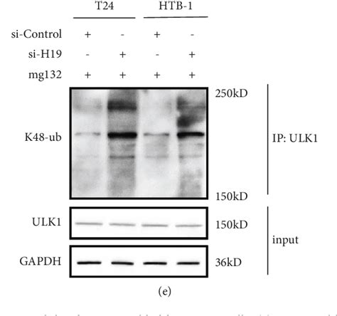 Figure 5 From Long Noncoding RNA H19 Derived From M2 Tumor Associated