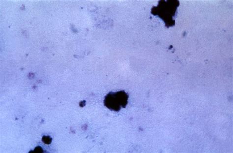 Free Picture Thick Film Photomicrograph Two Young Growing