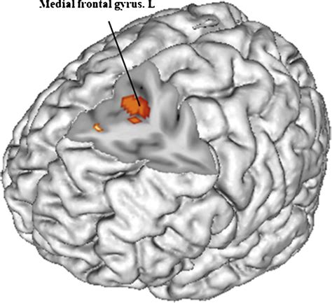 Common Neural Correlates Of Deceptive Responses Truthful Responses Download Scientific