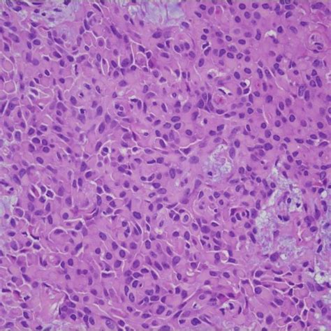 Haematoxylin And Eosin Stained Sections 400 × Magnification Of The