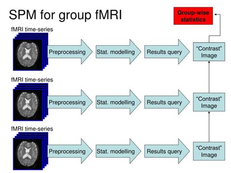 Ppt Voxel Based Morphometry With Unified Segmentation Powerpoint