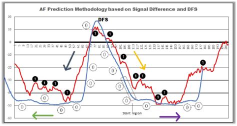 Atrial Fibrillation Prediction Using Signal Difference And Dfs