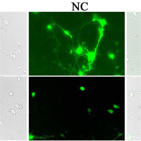 Morphology Of Primary Cortical Neurons On Days 1 3 And 6 Scale Download Scientific Diagram
