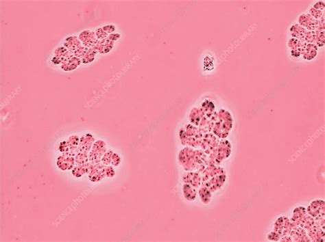 Salt Lake Bacteria Light Micrograph Stock Image C002 6356