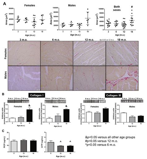 Age And Sex Dependent Differences In Extracellular Matrix Metabolism