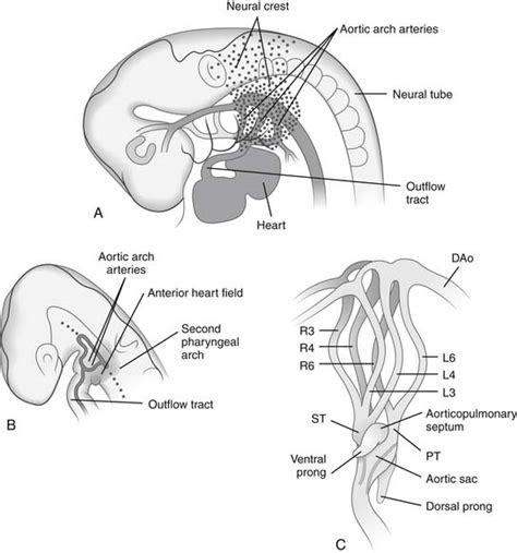 Cardiac Embryology And Genetics Thoracic Key