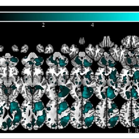 Dorsal And Ventral Attention Networks Dorsal Attention Network In A Download Scientific